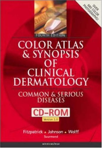 Color Atlas and Synopsis of Clinical Dermatology, Book & CD-ROM ...