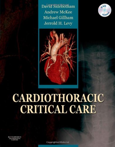 Cardiothoracic Critical Care: David Sidebotham, Andrew McKee, Michael ...