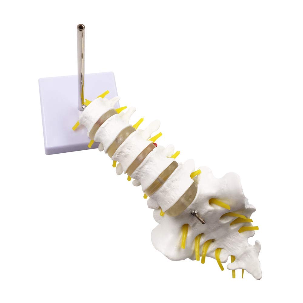Spinal Nerves Herniated Disc Model Life Size Human Spine Model – 1:1 ...