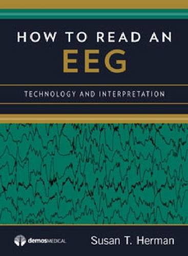 How to Read an EEG: Technology and Interpretation: 9781936287246 ...
