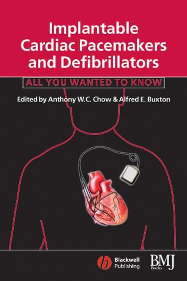 Buy Implantable Cardiac Pacemakers and Defibrillators - All You Wanted ...