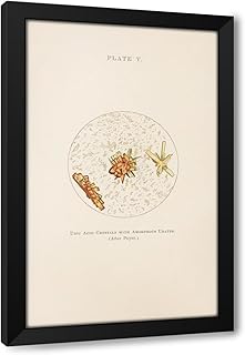 Urine Test: Understanding Amorphous Urate Crystals | MedShun