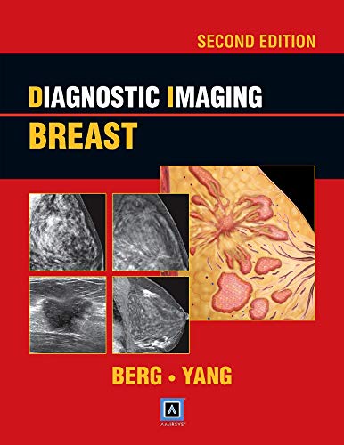 Diagnostic Imaging: Breast: 9781931884730: Medicine & Health Science ...