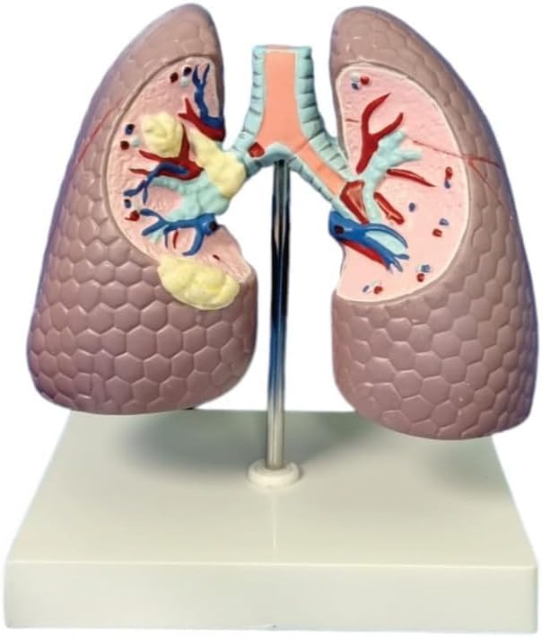 GD ANATOMICALS ® Lung Model - Educational Tool for Medical Study ...