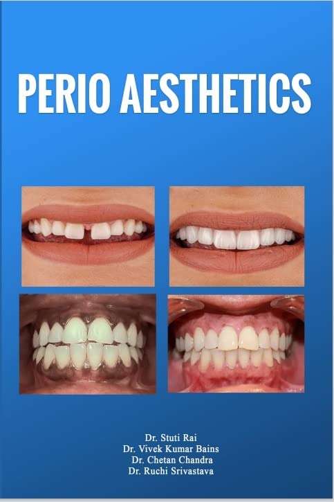 Buy Perio Aesthetics Book Online at Low Prices in India | Perio ...
