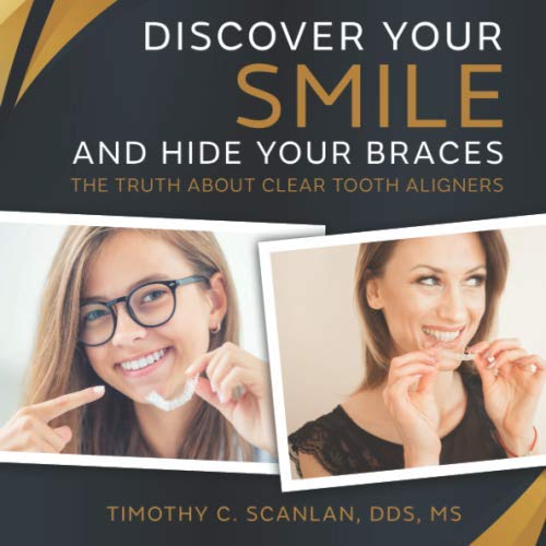 Discover Your Smile and Hide Your Braces: The Truth About Clear Tooth ...