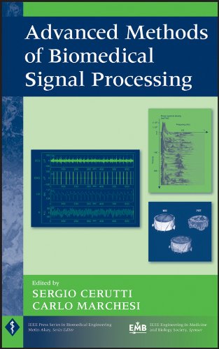 Amazon.com: Advanced Methods of Biomedical Signal Processing (IEEE ...