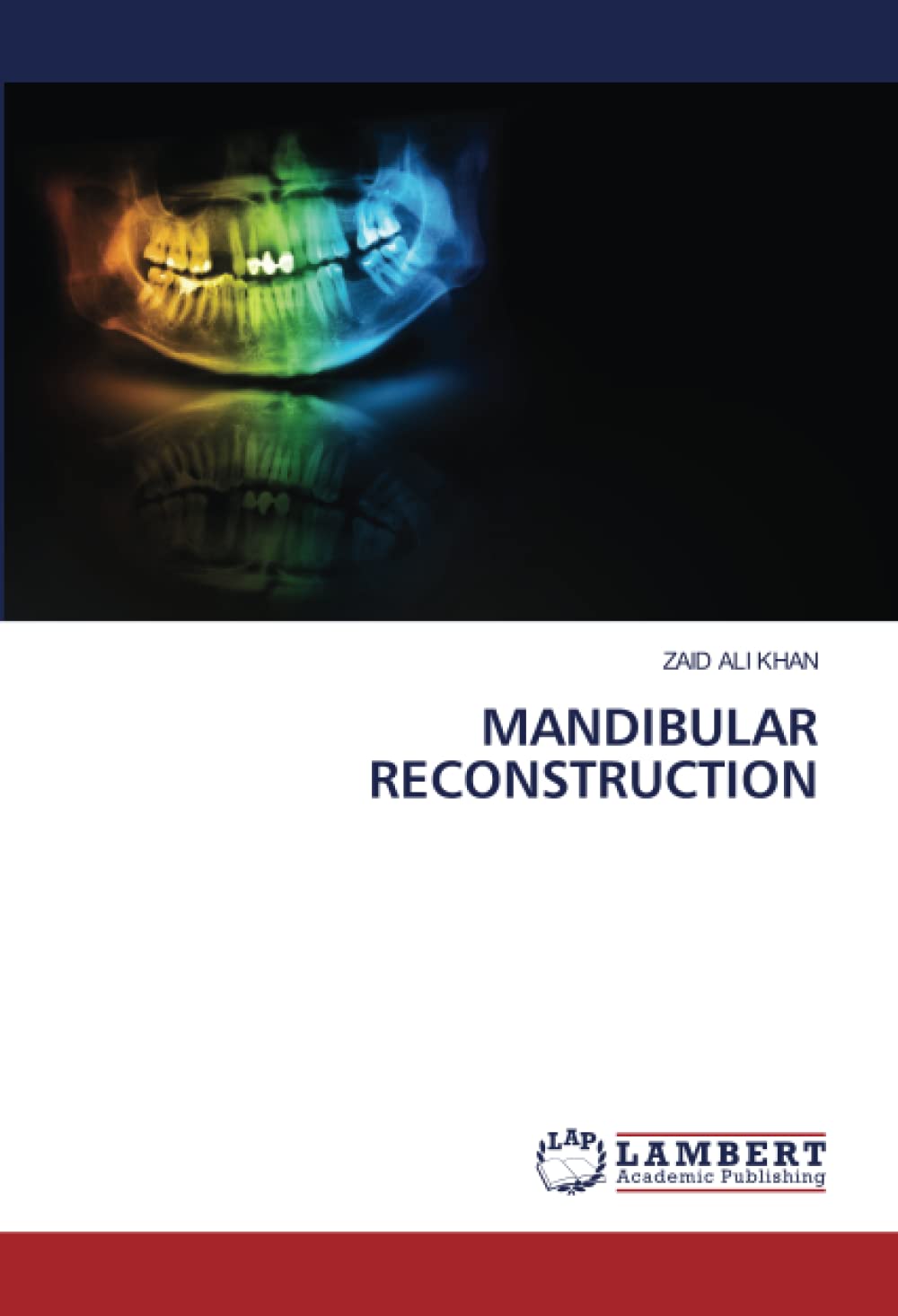 MANDIBULAR RECONSTRUCTION: KHAN, ZAID ALI: 9786204985008: Amazon.com: Books
