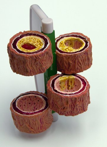 Buy 4-Piece Artery Model | Human Body Anatomy Replica of Artery w ...
