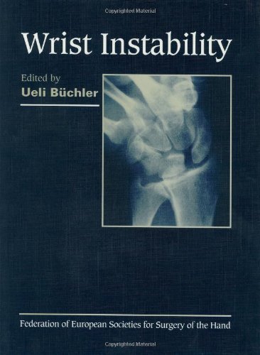 Wrist Instability: 9781853173202: Medicine & Health Science Books ...
