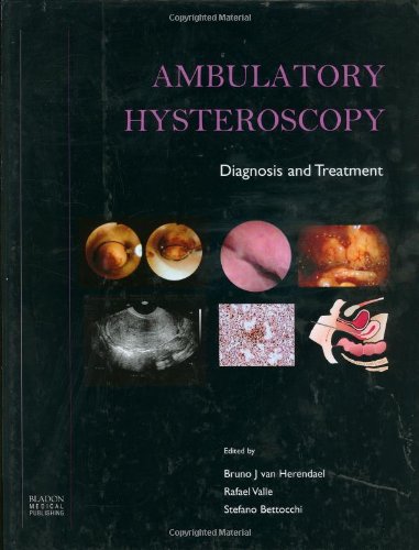 Buy AMBULATORY HYSTEROSCOPY: DIAGNOSIS AND AMP; TREATMENT Book Online ...