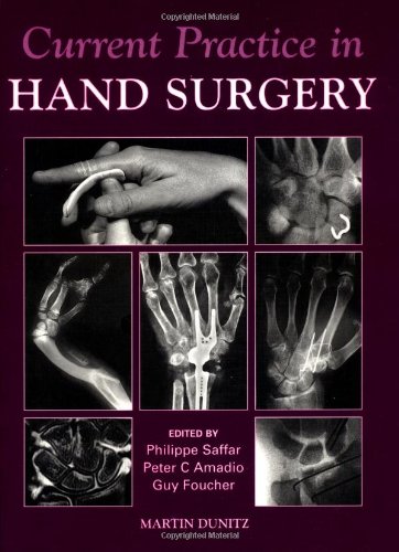 Buy Current Practice in Hand Surgery Book Online at Low Prices in India ...