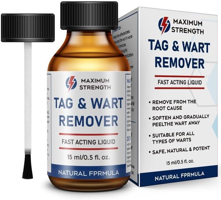 Find The Best Home Mole Removal Kit Reviews & Comparison - Katynel