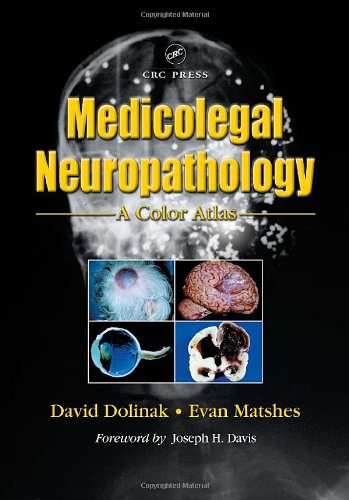 Medicolegal Neuropathology: A Color Atlas: 9780849313615: Medicine ...