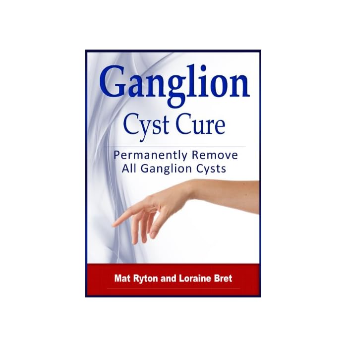Buy Ganglion Cyst Cure: Complete guide to ganglion cyst causes, types ...