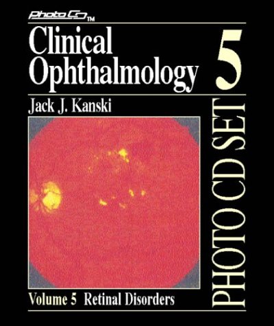 Retinal Disorders (Clinical Ophthalmology Photo Cd Set): Kanski, Jack J ...