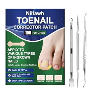 Amazon.com : 100pcs Ingrown Toenail Treatment, Breathable ...