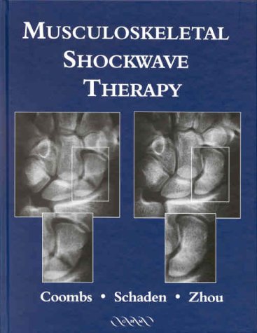 Musculoskeletal Shockwave Therapy: 9781841100586: Medicine & Health ...