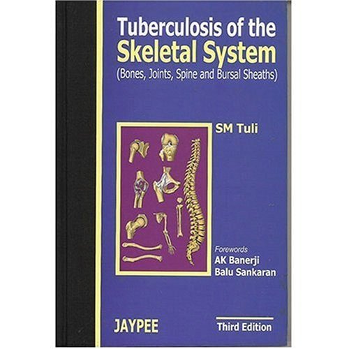 Amazon | Tuberculosis of the Skeletal System | Tuli, S. M ...