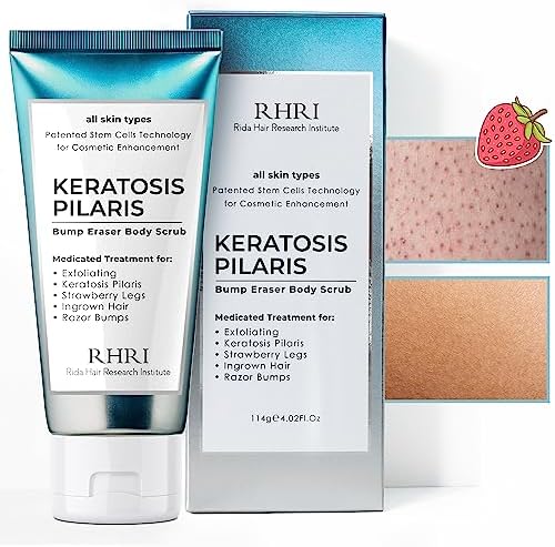 Amazon.com : DERMAdoctor KP Bump Eraser Body Scrub Dermatologist ...