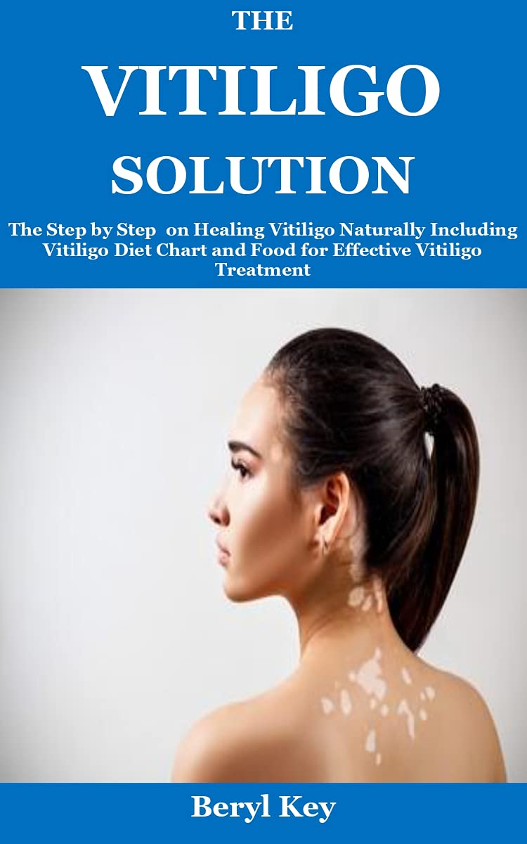 Buy THE VITILIGO SOLUTION: The Step by Step on Healing Vitiligo ...