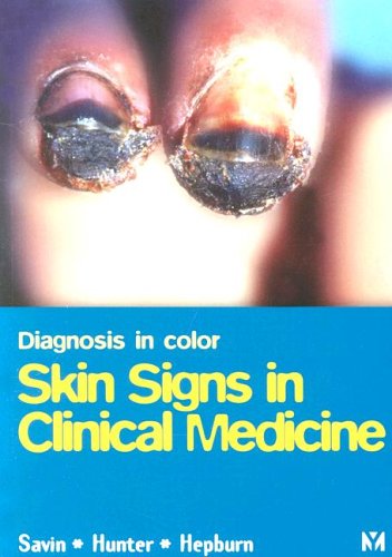 Diagnosis In Color: Skin Signs in Clinical Medicine (Diagnosis in ...