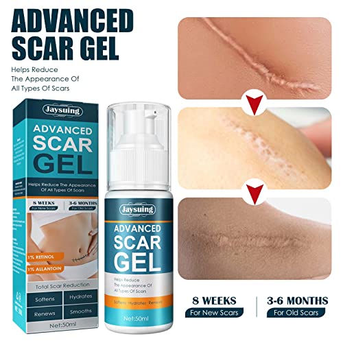 50ML Advanced Scar Gel, Narbengel, Narbencreme, Narbenpflege für ...