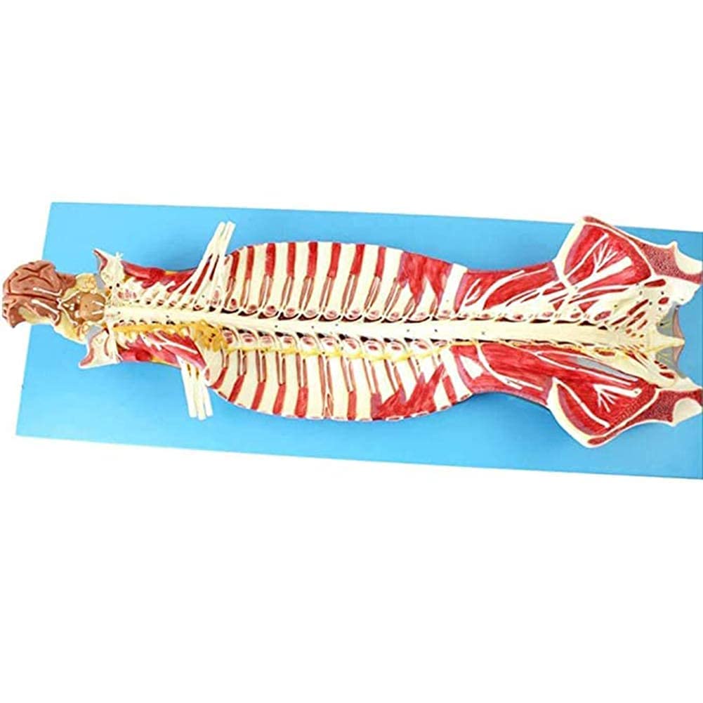 Buy Learning Props Spinal Nerve Model Inside Spinal Canal,This Model ...