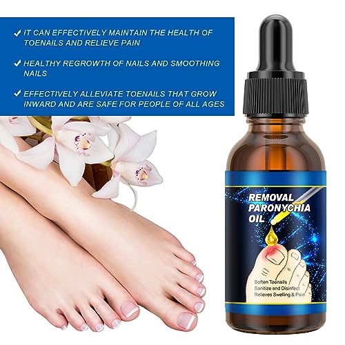 Removal Paronychia Oil, 30ML Toenail Care Anti Paronychia Relief Oil ...