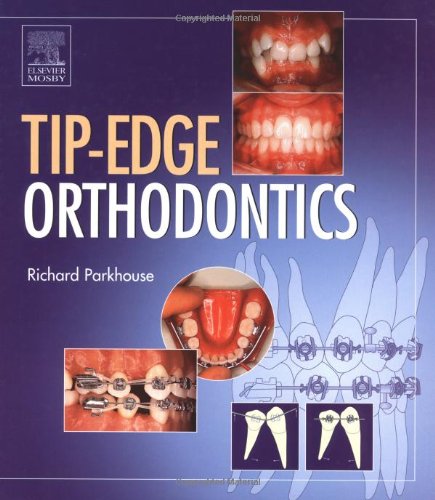The Tip-Edge Orthodontic System: 9780723432289: Medicine & Health ...