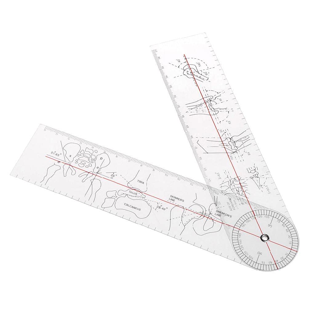 Goniometer Angle Medi Cal Ruler Rule Joint Orthopedics Tool Instruments ...