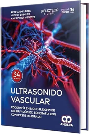 Ultrasonido vascular Modo B Doppler Color y Dúplex ecografía con ...