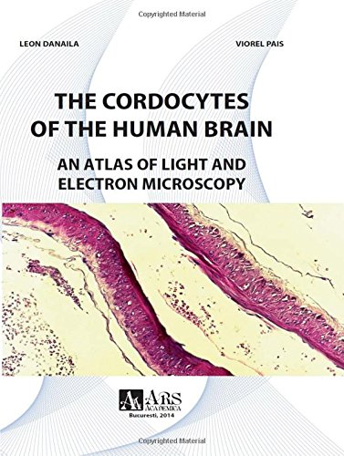 The Cordocytes of the Human Brain. An Atlas of Light and Electron ...