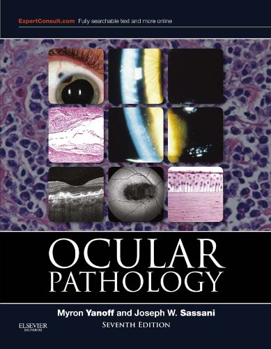 Amazon.co.jp: Ocular Pathology: Expert Consult (Expert Consult Title ...