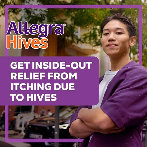 Allegra Hives Non-Drowsy Antihistamine Tablets, 30-Count, 24HR Hives ...
