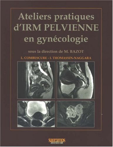 Amazon.fr - ATELIERS PRATIQUES D IRM PELVIENNE EN GYNECOLOGIE (0000 ...