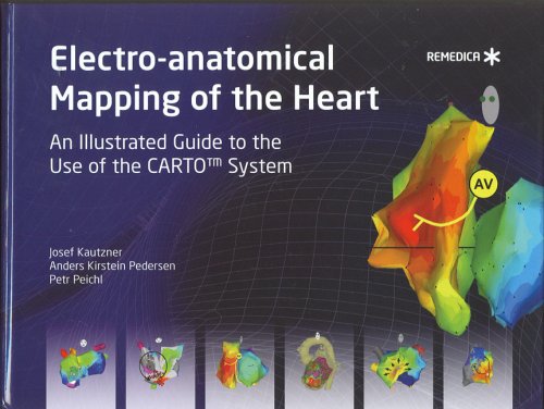 Amazon | Electro-anatomical Mapping of the Heart: An Illustrated Guide ...