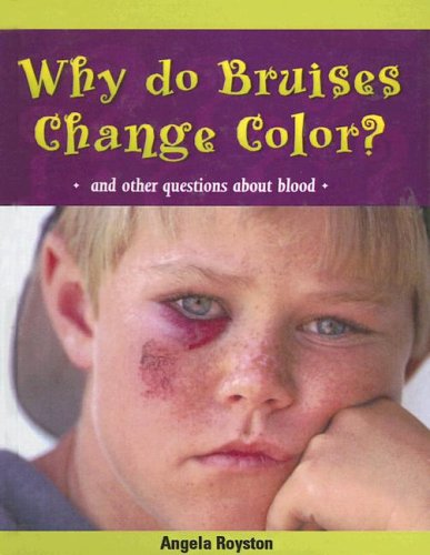 Why Do Bruises Change Color?: And Other Questions about Blood (Body ...