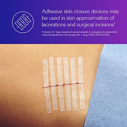 Snapklik.com : 3M Steri-Strip Reinforced Adhesive Skin Closures, R1542 ...