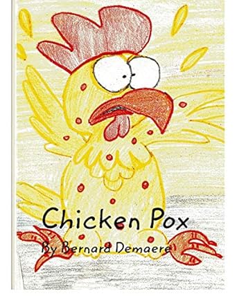 Buy Chicken Pox Book Online at Low Prices in India | Chicken Pox ...