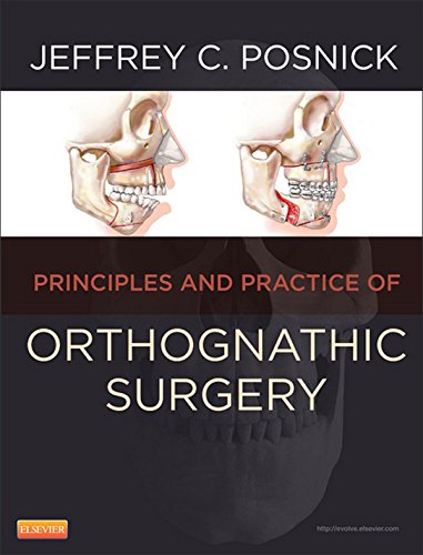 Orthognathic Surgery (English Edition) eBook : Posnick, Jeffrey C ...