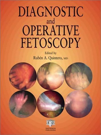 Diagnostic and Operative Fetoscopy: 9781850707141: Medicine & Health ...