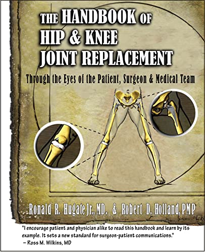 Handbook of Hip & Knee Joint Replacement: Through the Eyes of the ...