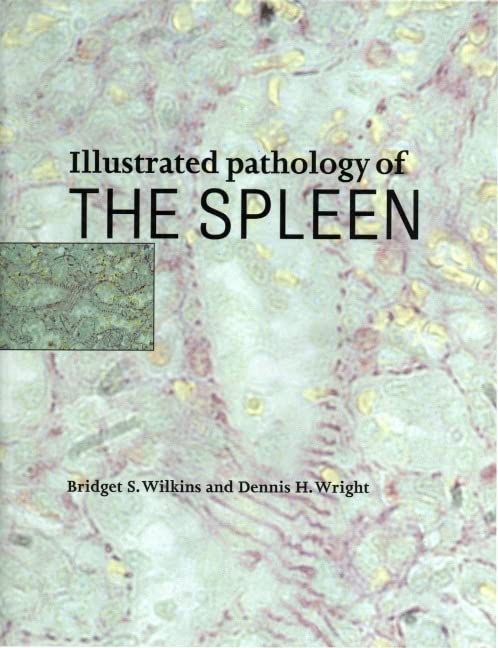 Illustrated Pathology of the Spleen 1 Edition – Wiselibs.shop