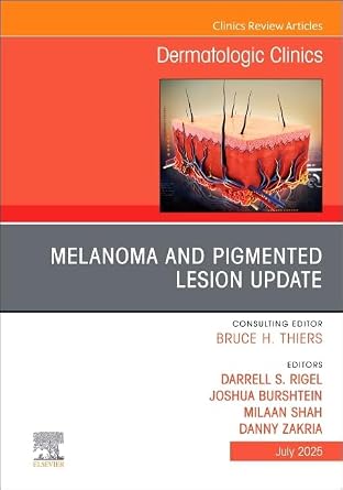 Melanoma and Pigmented Lesion Update, An Issue of Dermatologic Clinics ...