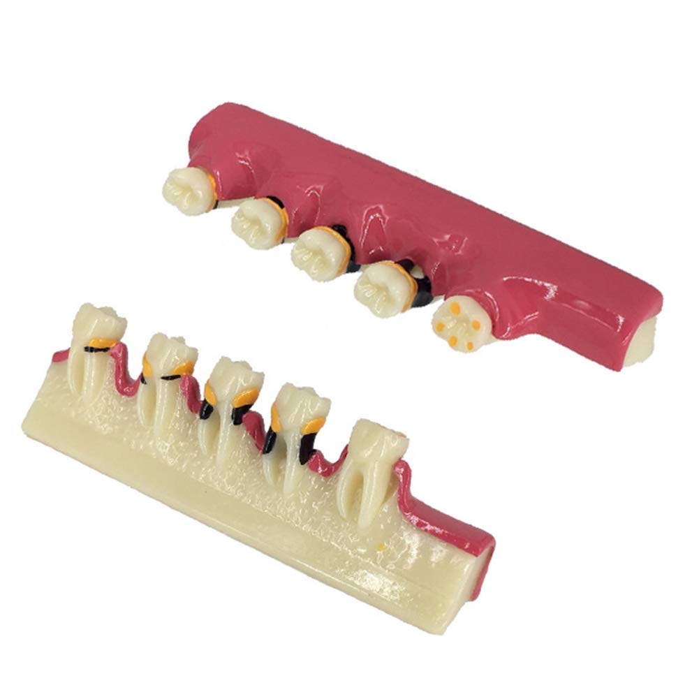Xieji Periodontitis Periodontal Disease Classification Model Dental ...