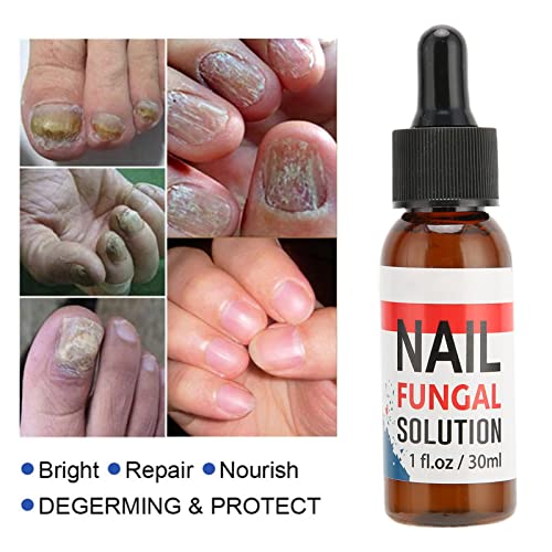 Fungal Nail Renewal, Multi-Purpose Nail Repair, Nail Fungus Treatment ...