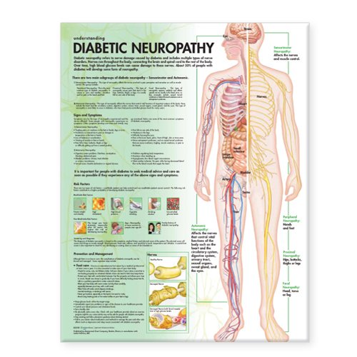 Understanding Diabetic Neuropathy Anatomical Chart by - Amazon.ae