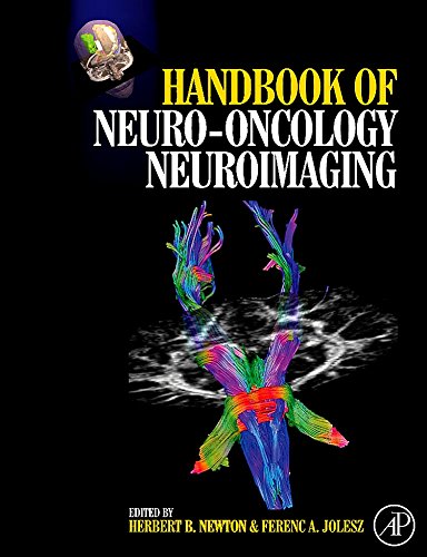 Handbook of Neuro-Oncology Neuroimaging: 9780123708632: Medicine ...