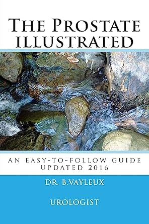 The Prostate illustrated: In 10 points: Vayleux, Dr Bertrand ...